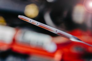 Kia Rio Not Shifting Gears: Causes and Fixes | Drivetrain Resource